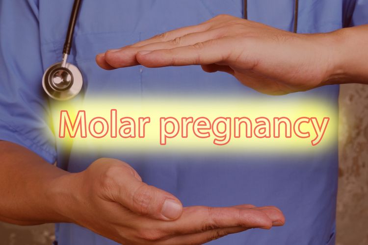 Hamil Anggur Parsial dan Hamil Anggur Lengkap, Apa Bedanya? - Kanya.ID